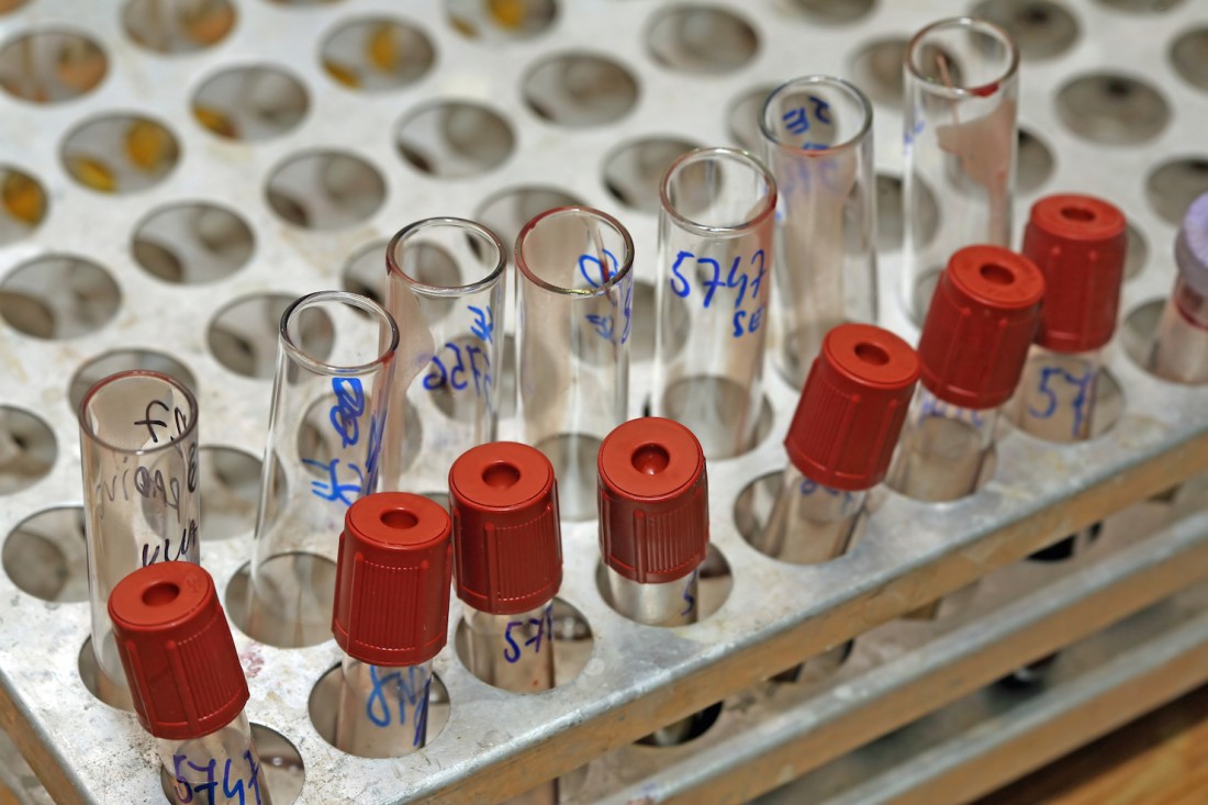 Cerulean Pharma Inc (NASDAQ:CERU): What's Next? - Market Exclusive